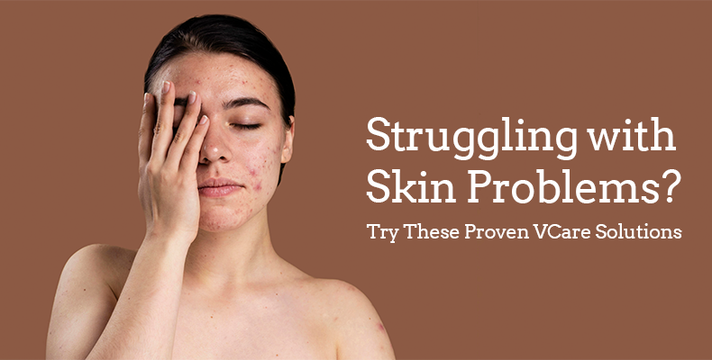 Top Skin Problems & Natural Treatments for Clear Skin