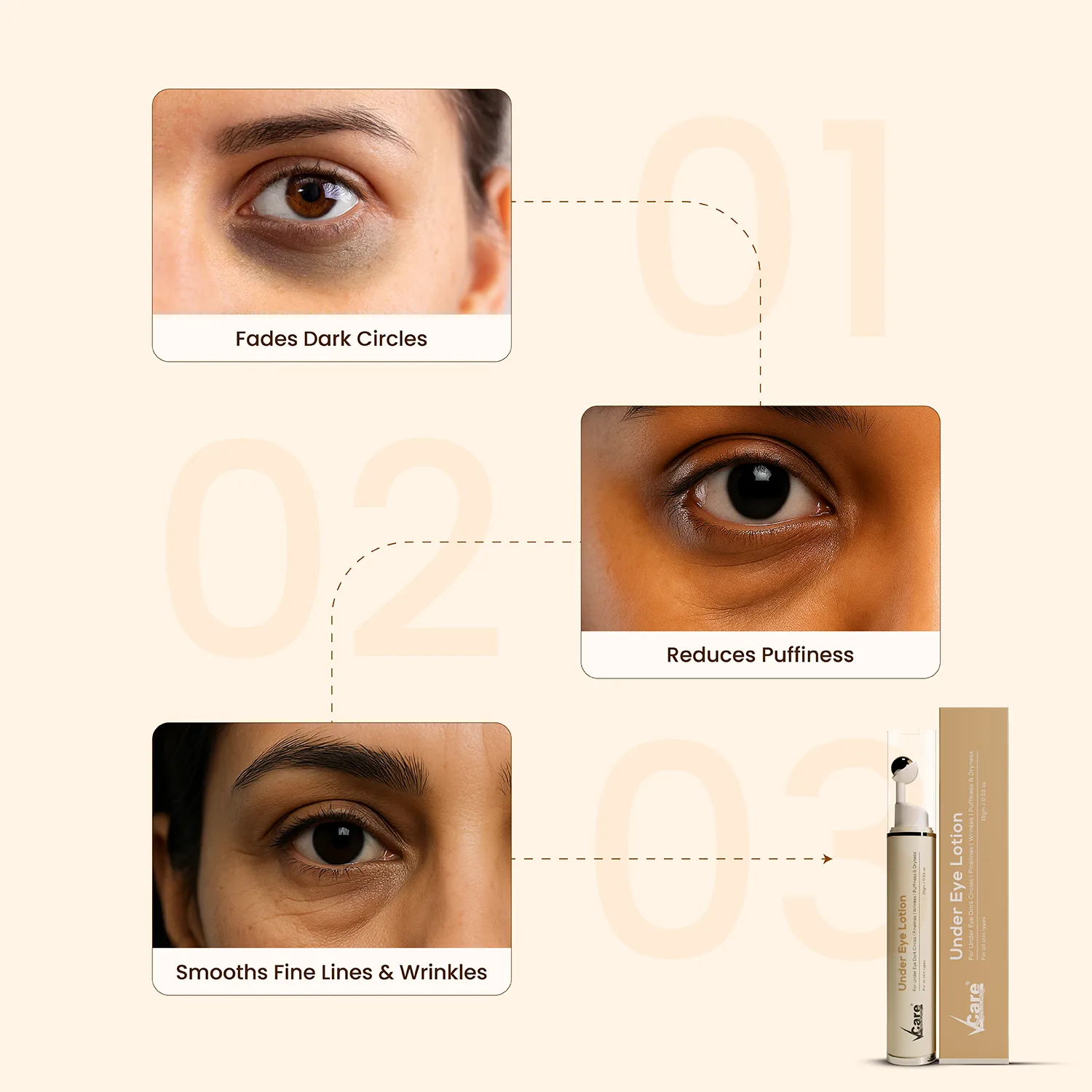 Under Eye Lotion for Dark Circles, Puffiness & Wrinkles – Hydrating Eye ...