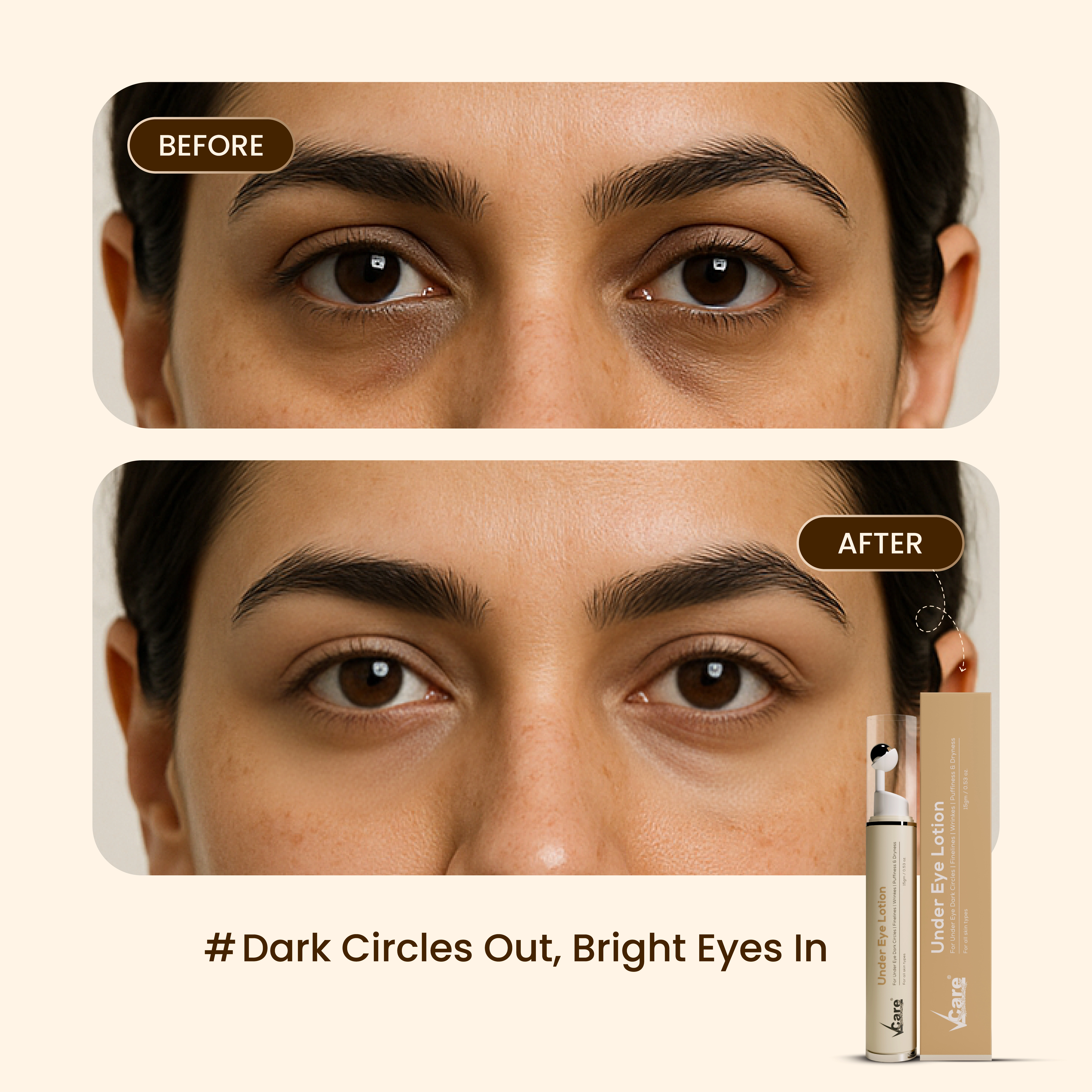 Under Eye Lotion for Dark Circles, Puffiness & Wrinkles – Hydrating Eye ...